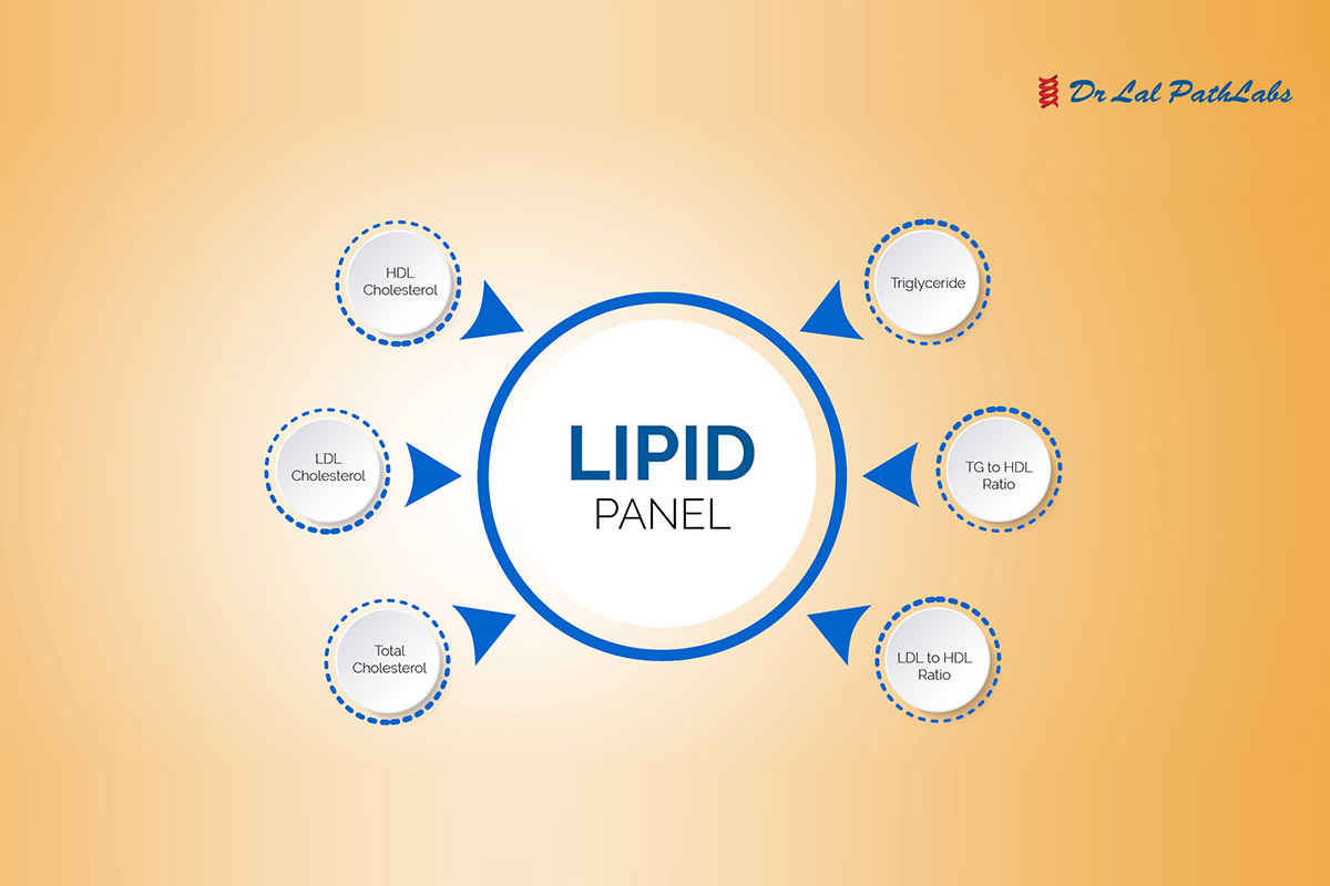 Lipid Profile Test: What It Is, Purpose, Preparation & Results